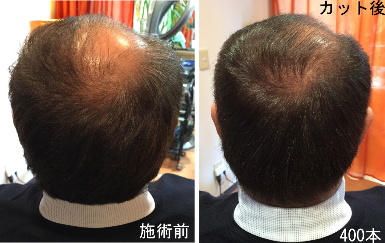 N4 Hair ==============BARBER