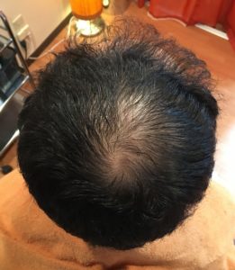 29 | 7月 | 2017 | N4 Hair (エヌフォーヘア)
