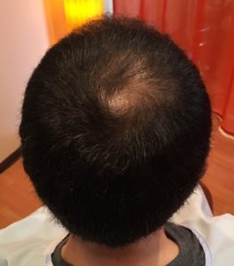 27 | 6月 | 2017 | N4 Hair (エヌフォーヘア)