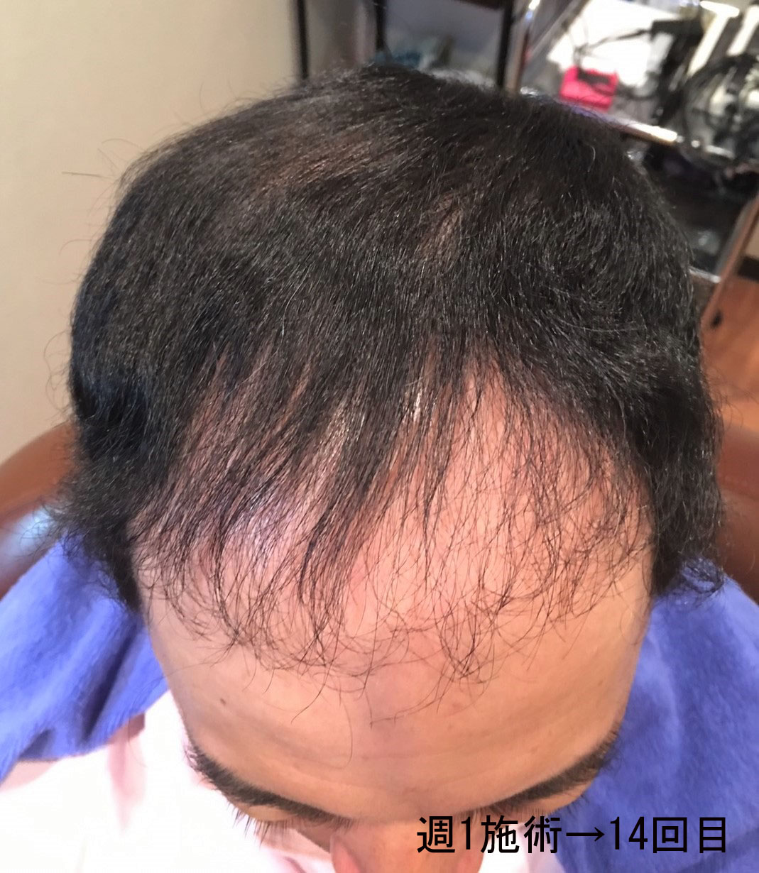 29 | 7月 | 2017 | N4 Hair (エヌフォーヘア)