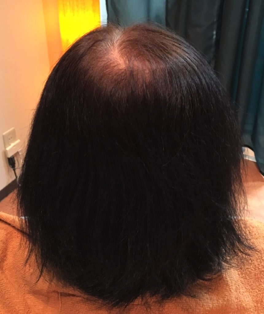 19 | 10月 | 2017 | N4 Hair (エヌフォーヘア)